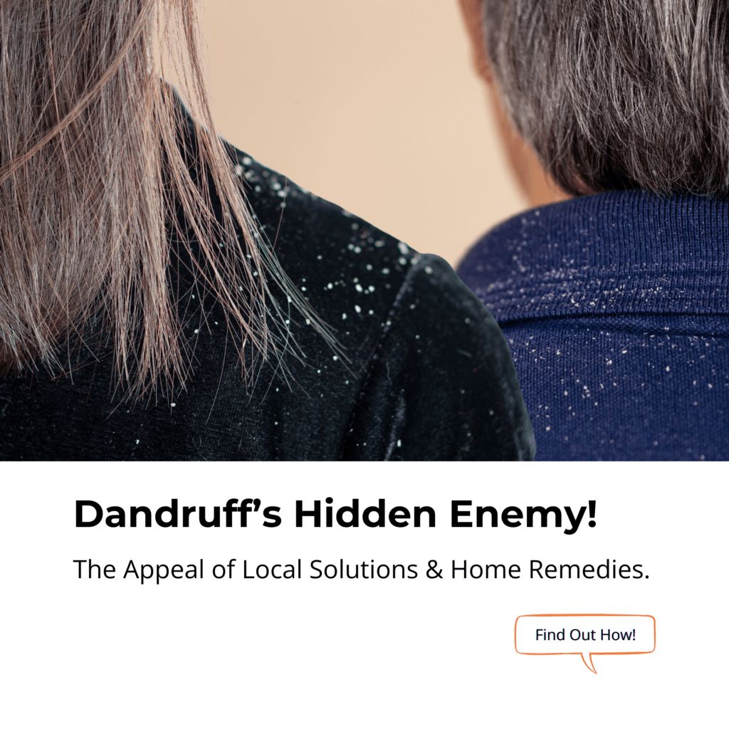 Effective Dandruff Treatment at Home: Say Goodbye to Flakes